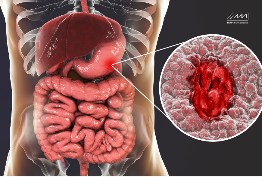 Graloxen | Alivio Eficaz para Reflujo y Gastritis | Magaldrato/Dimeticona